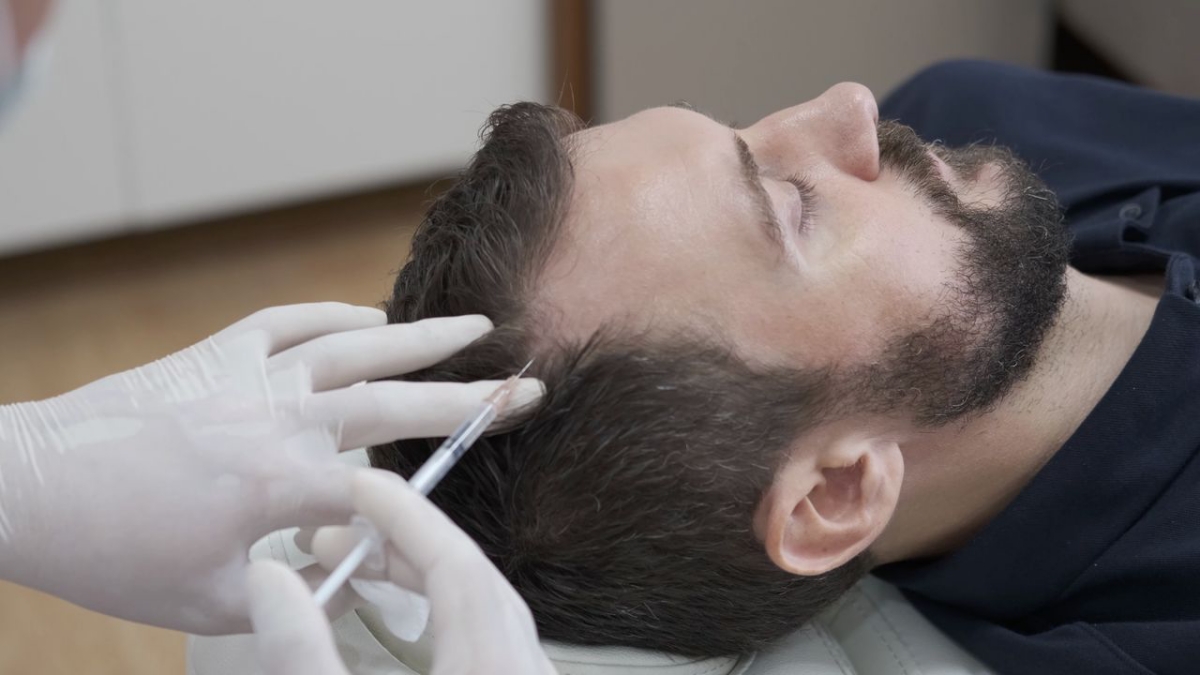 Understanding PRP Hair Loss Treatment: How Platelet-Rich Plasma Therapy ...