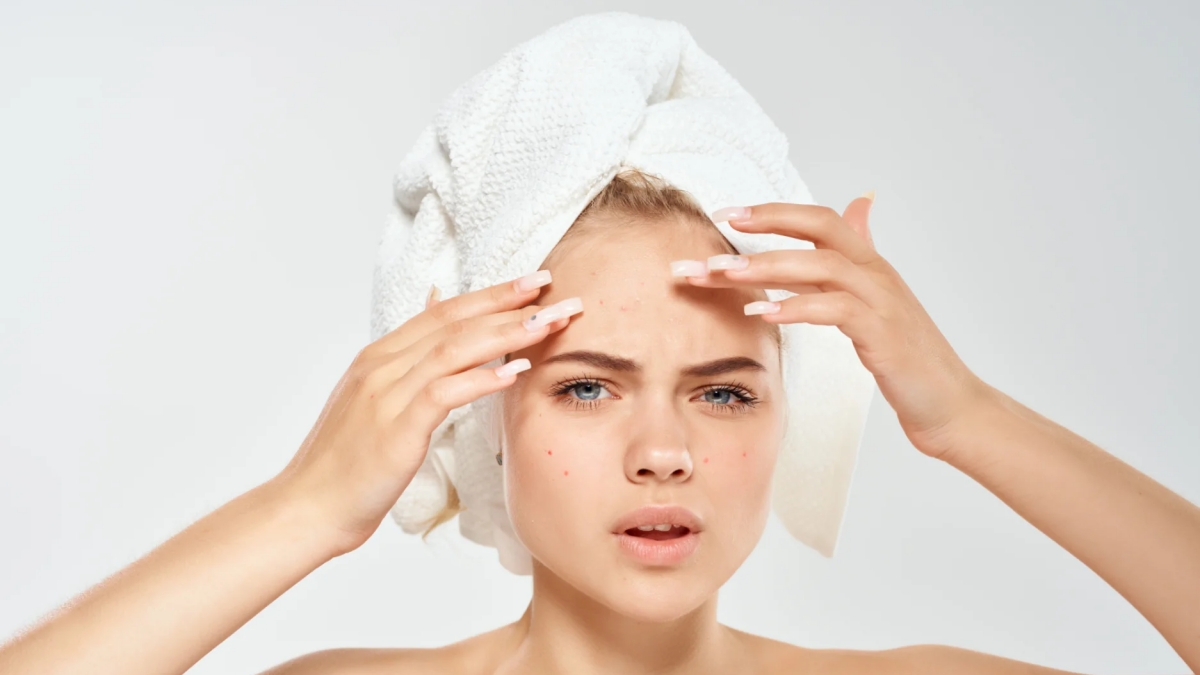Ready to Banish Blemishes? Here's The 2024 Guide to Effective Acne Spot ...