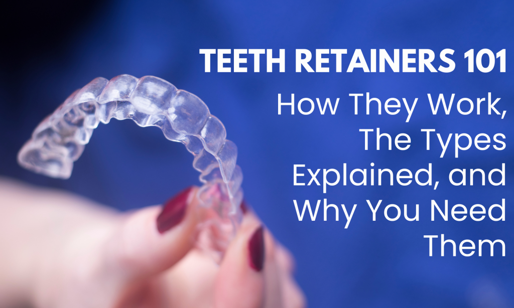 Teeth Retainers 101: How They Work, The Types Explained (Fixed vs ...