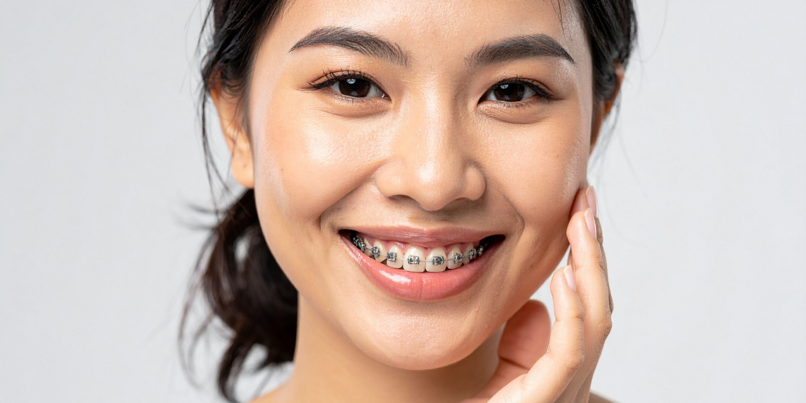 How to Know If You Need Braces: Signs You Shouldn’t Ignore - Readability